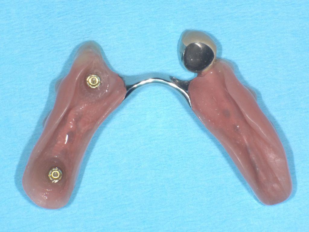 SHOFU DENTAL DIGITAL CAMERA - Misovic