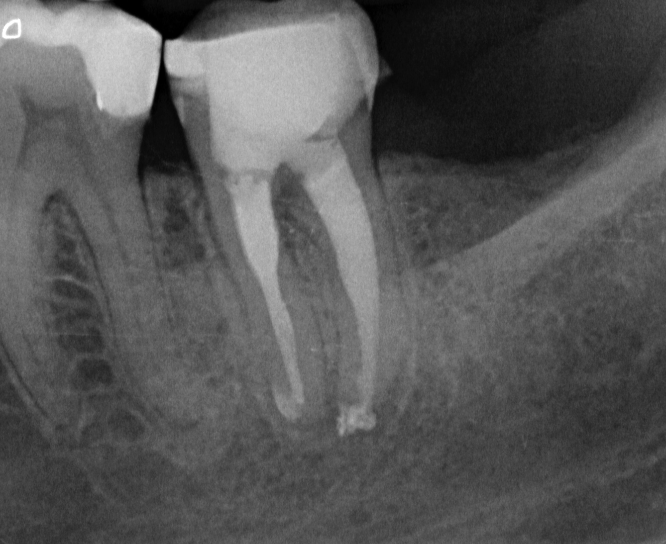 Endodontologie – Wurzelbehandlung - Misovic